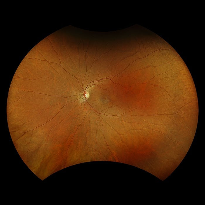 How Does Retinal Scanning Work?